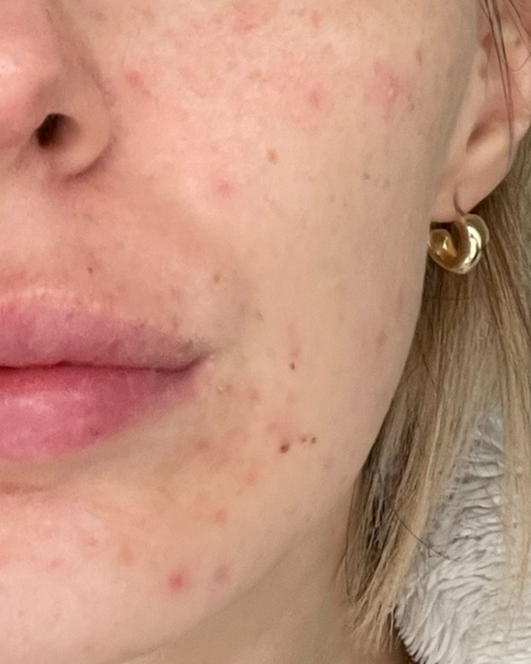 Why SkinScript? – Skin Script